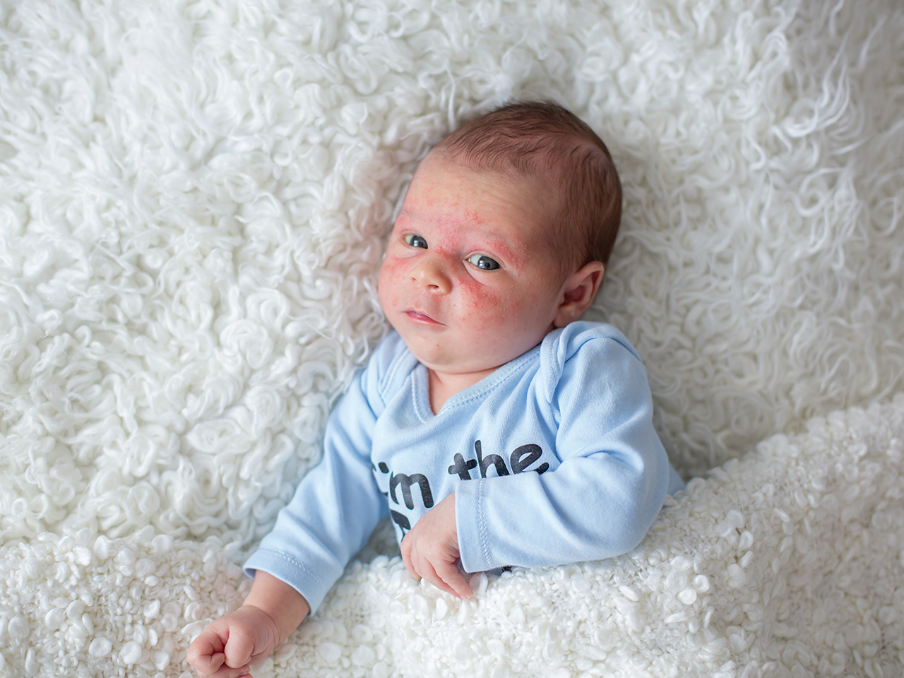 Expert Tips for Caring for Your Infant's Skin